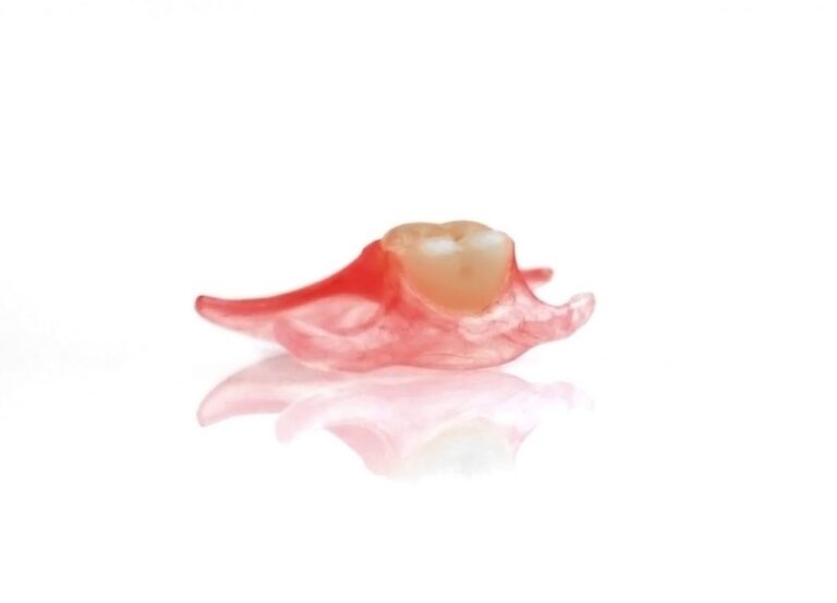 Nesbit Partial Dentures » DentKits