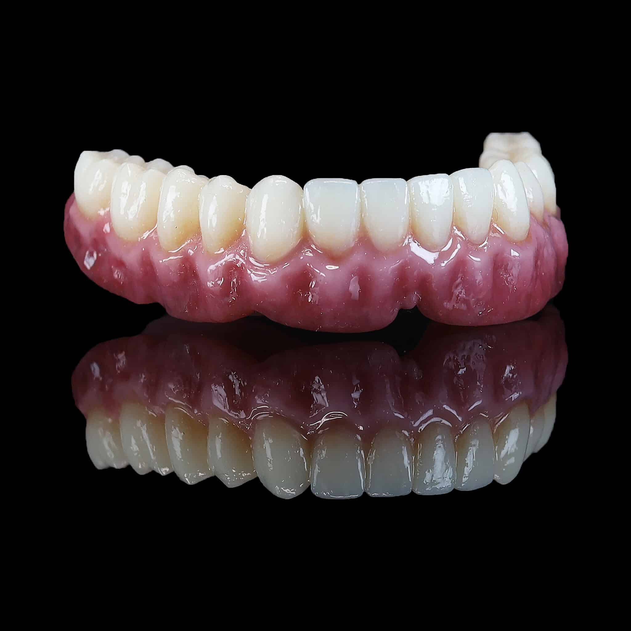 Full Dentures Online — Natural Look, Perfect Fit | DentKits