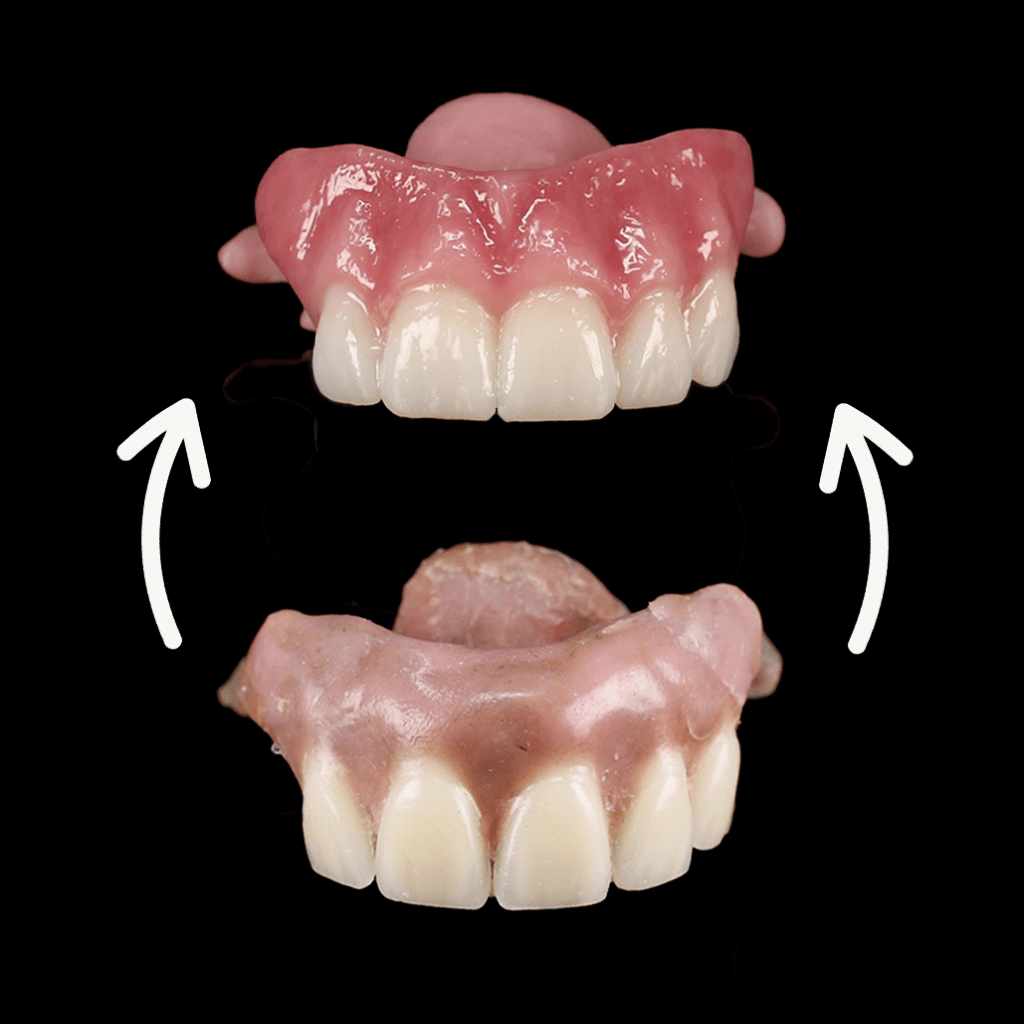 Dentures Online | Luxury Custom Dentures from Home by DentKits