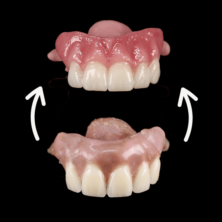 Dentures Online | Luxury Custom Dentures from Home by DentKits