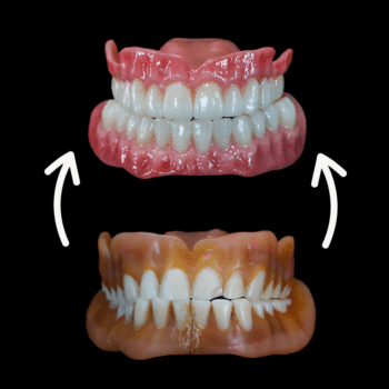 Dentures Online | Luxury Custom Dentures from Home by DentKits